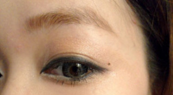 Lucky Moles on Face, Auspicious Facial Moles