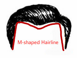 Types of Forehead Hairlines, Hairline Shapes and Meanings