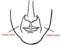 Cheek Lines When Smiling, Fa Ling Lines, Nasolabial Folds, Laugh Lines ...