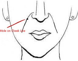 Cheek Lines When Smiling, Fa Ling Lines, Nasolabial Folds, Laugh Lines ...